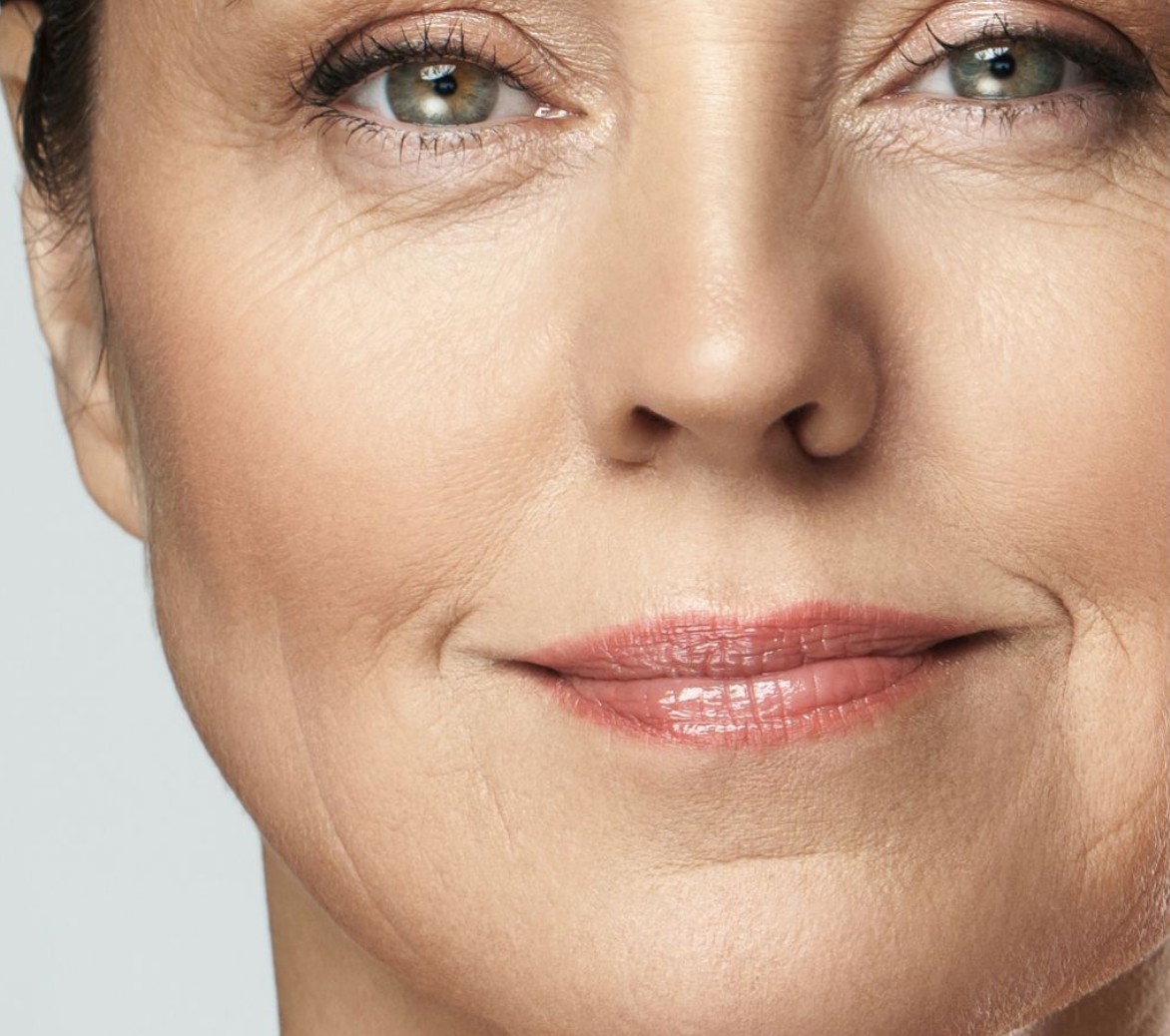 Best Thread Lifts Beverly Hills & Los Angeles, CA | Dr. Monika Kiripolsky